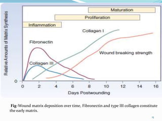 wound healing.pptx