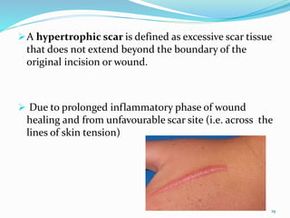 wound healing.pptx | First Aid | Injuries