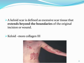 wound healing.pptx