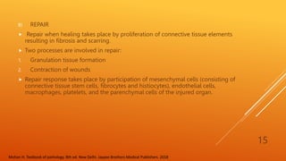 wound healing.pptx