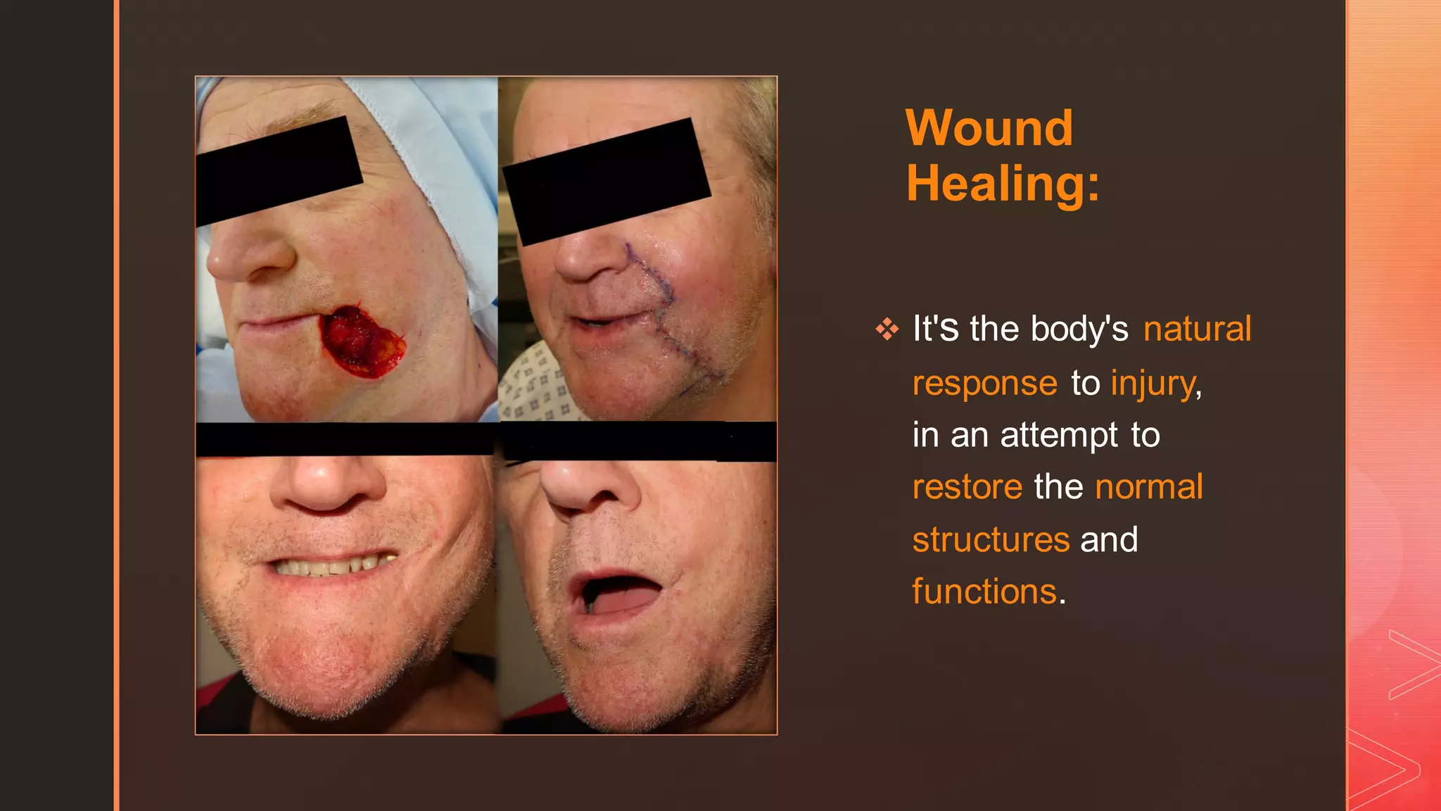 WOUND HEALING.pdf
