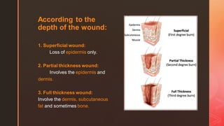 WOUND HEALING.pdf
