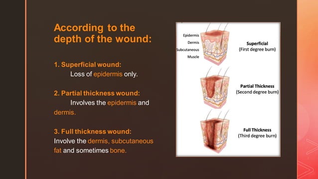 WOUND HEALING.pdf