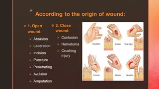 WOUND HEALING.pdf
