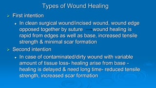 WOUND HEALING.ppt