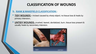 WOUND HEALING.pptx