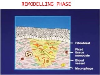 Wound healing. final yr 24 nov 23pptx.pptx