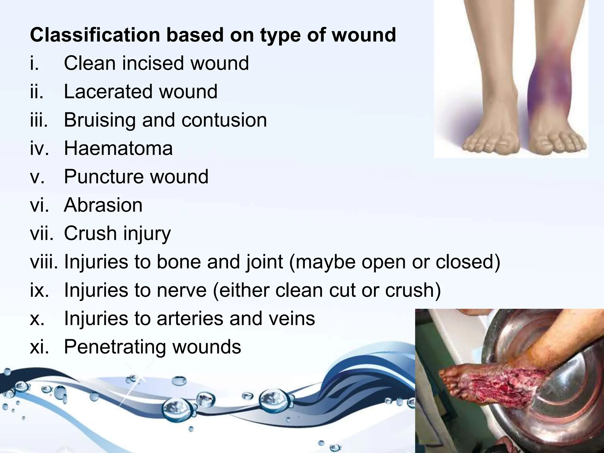 wound healing in surgical patients .pptx