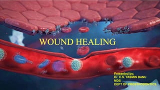 WOUND HEALING. wound healing in general, wound healing in dentistry. | PPT