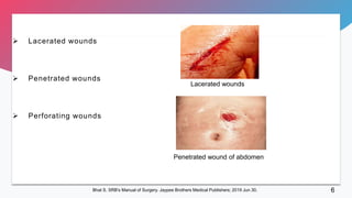 WOUND HEALING. wound healing in general, wound healing in dentistry. | PPTX