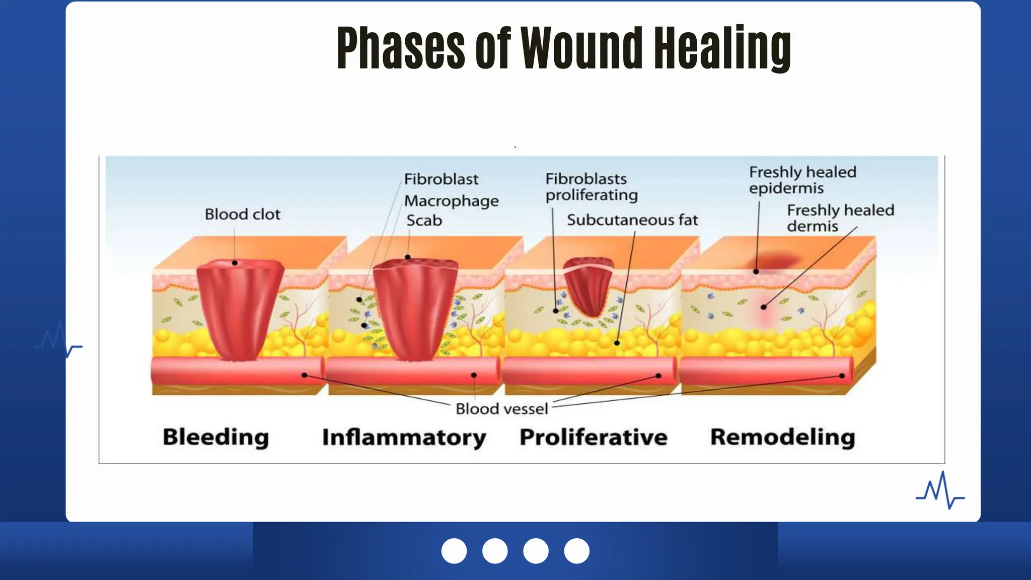 Wound healing PPT | PPTX