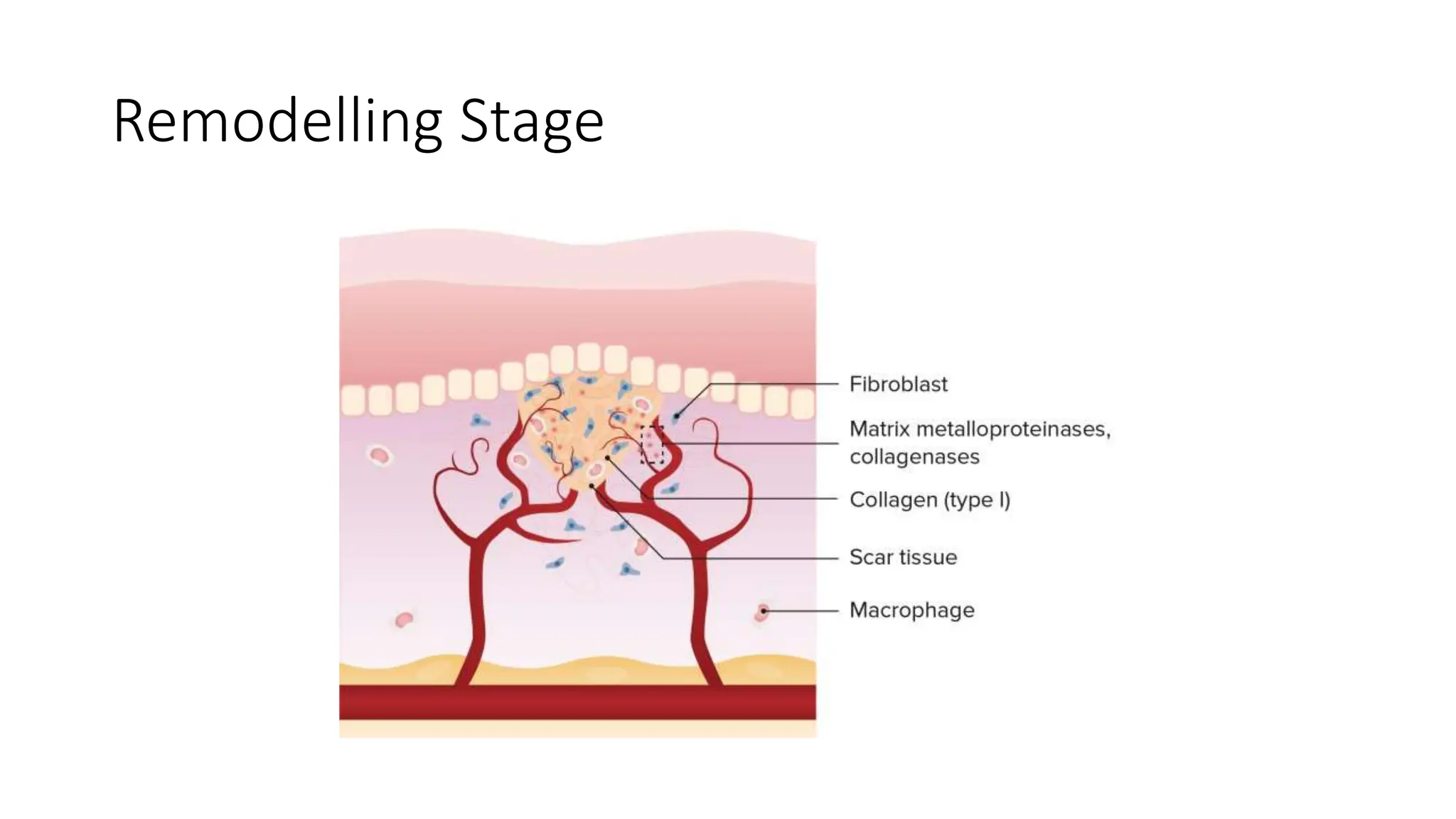WOUND HEALING - Stages, Types, Complications. | PPTX