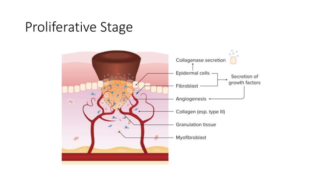 WOUND HEALING - Stages, Types, Complications. | PPTX | First Aid | Injuries