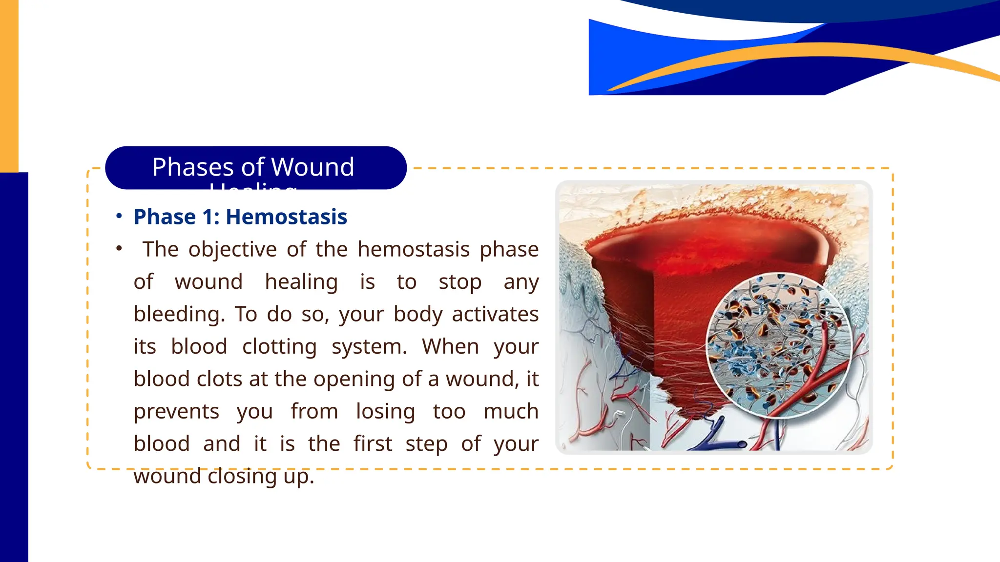 OVERVIEW ABOUT WOUND HEALING AND MANAGEMENT.pptx