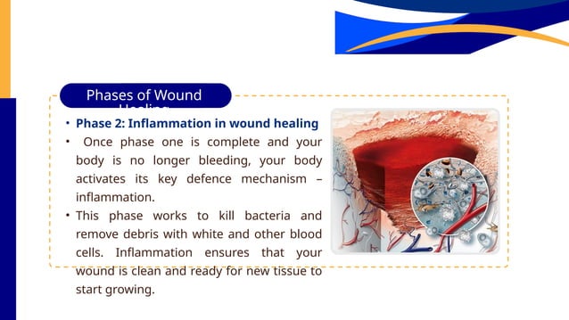 OVERVIEW ABOUT WOUND HEALING AND MANAGEMENT.pptx