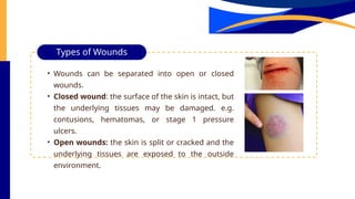OVERVIEW ABOUT WOUND HEALING AND MANAGEMENT.pptx