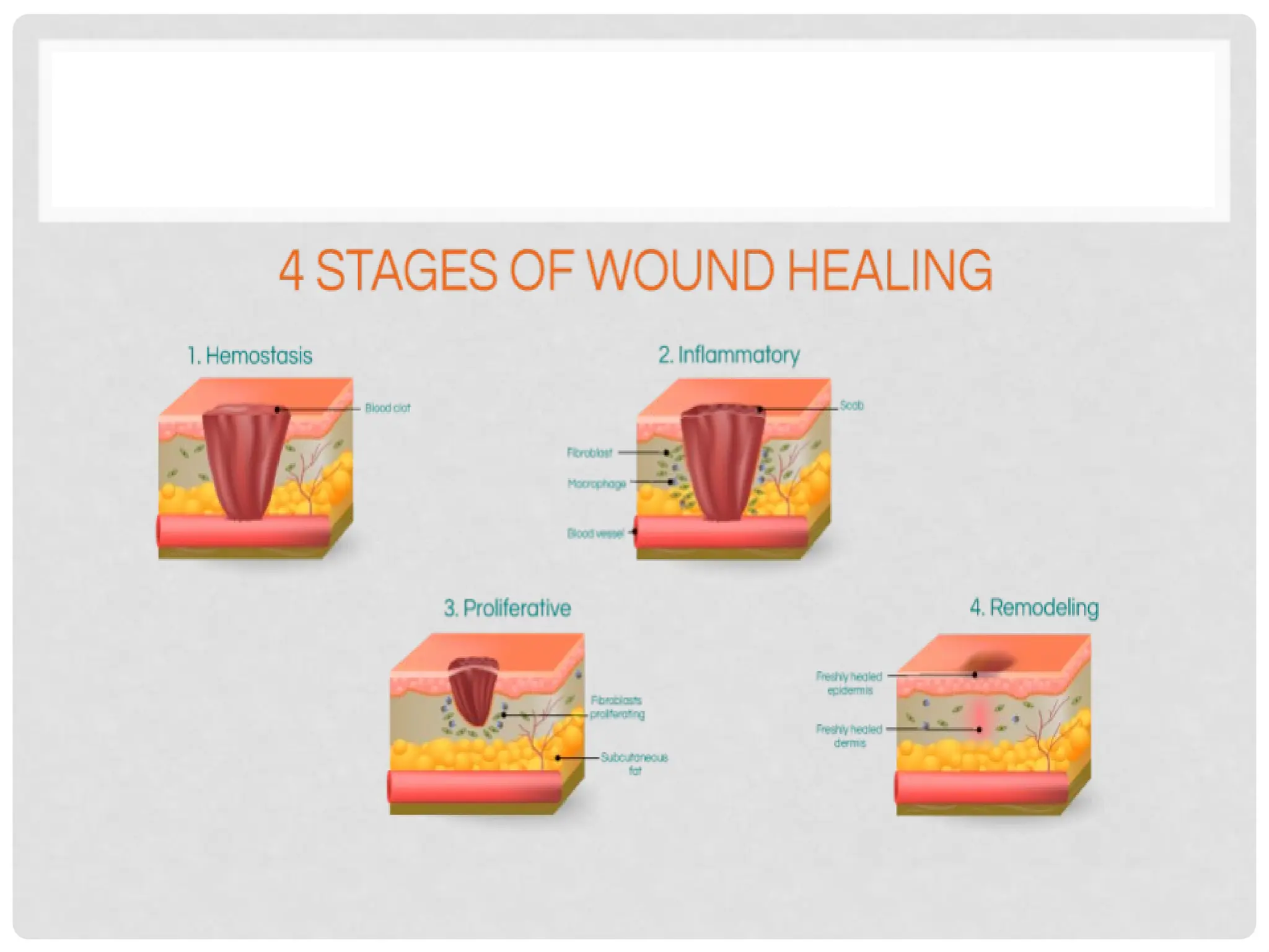 Wound healing and its nursing management .pptx