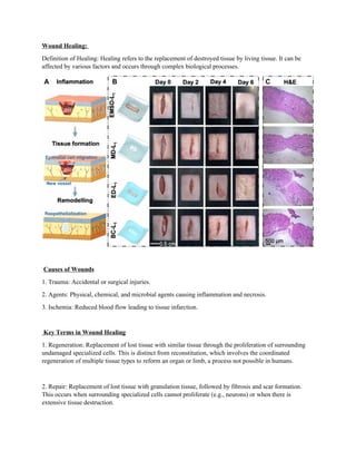 wound healing - General Surgery Definition, stages, classification | DOCX