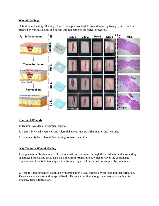 wound healing - General Surgery Definition, stages, classification | DOCX