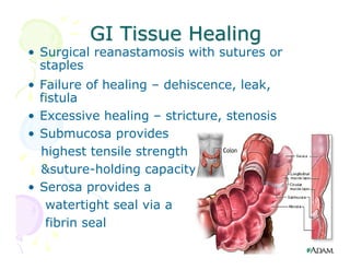WOUND HEALING - History and Phases.ppt.pdf