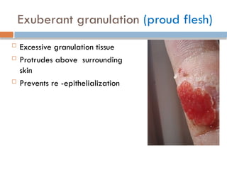 Wound healing, Stages of Wound healing.pptx
