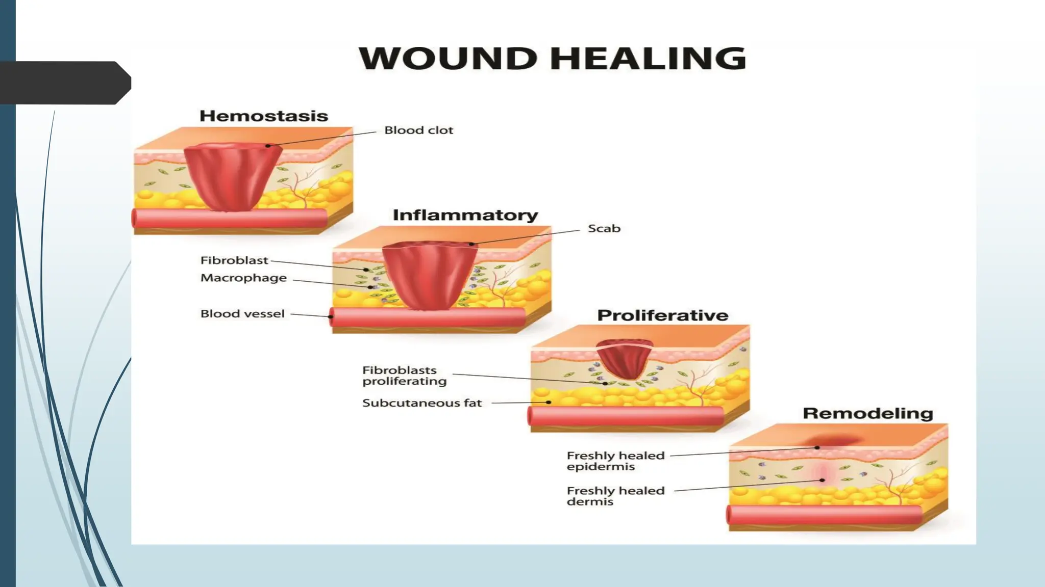 WOUND HEALING ....types of wound ..process of wound healing ...factors ...