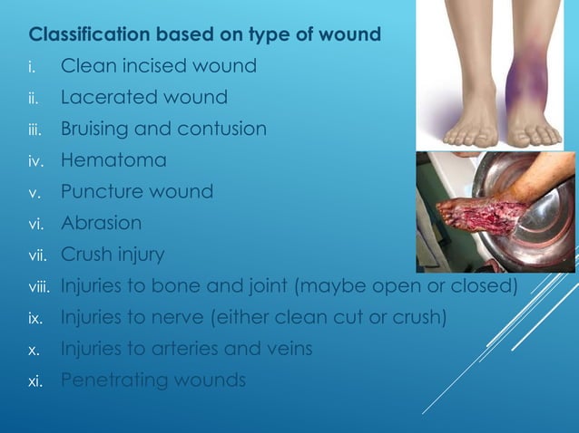 woundhealingwoundhealingwoundhealing.pptx