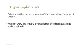 Wound Healing pathology chapter 3 .pptx