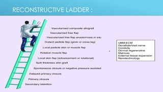 Wound healing Acute wounds : Trauma , surgical wounds ,burn.pptx