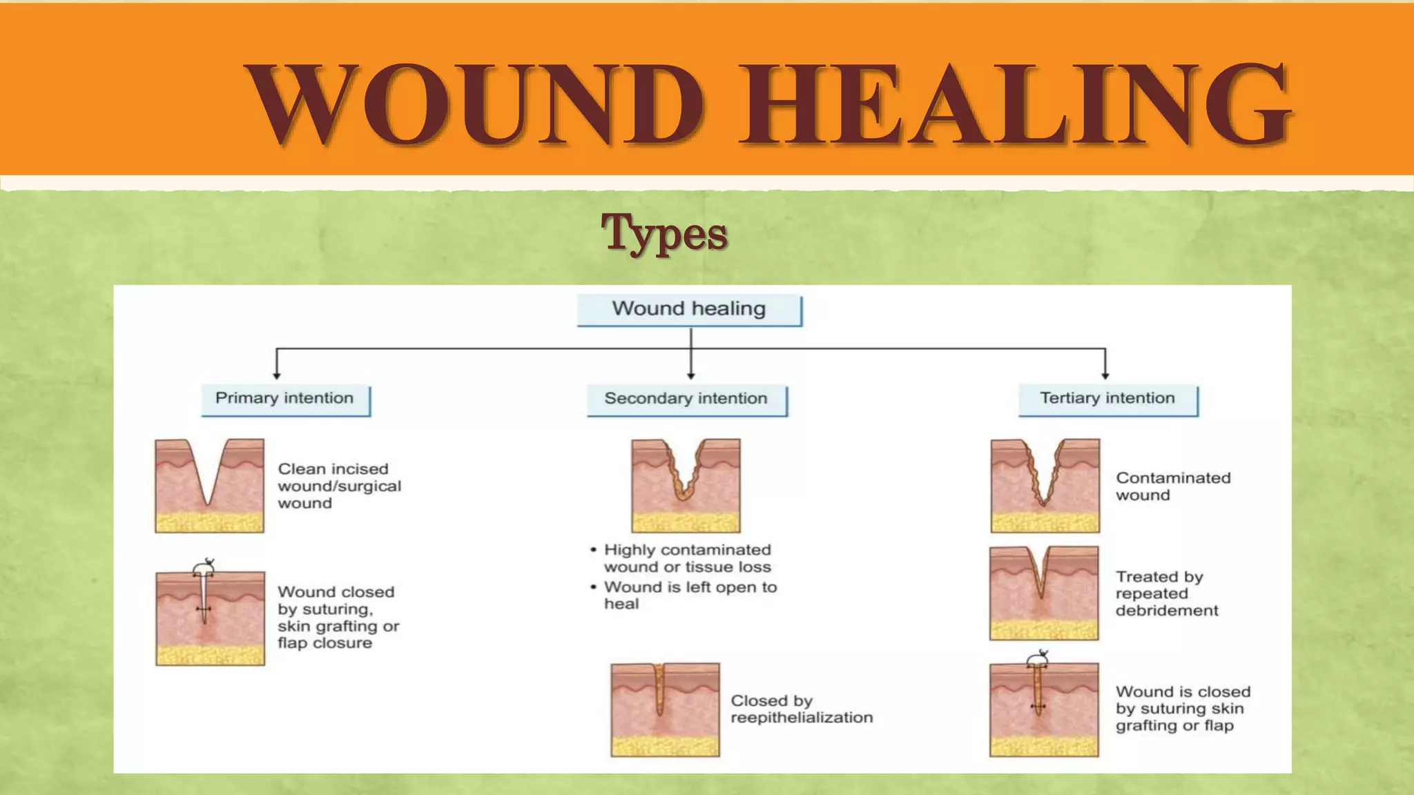 WOUND HEALING- Basic Principles in Surgery.pptx