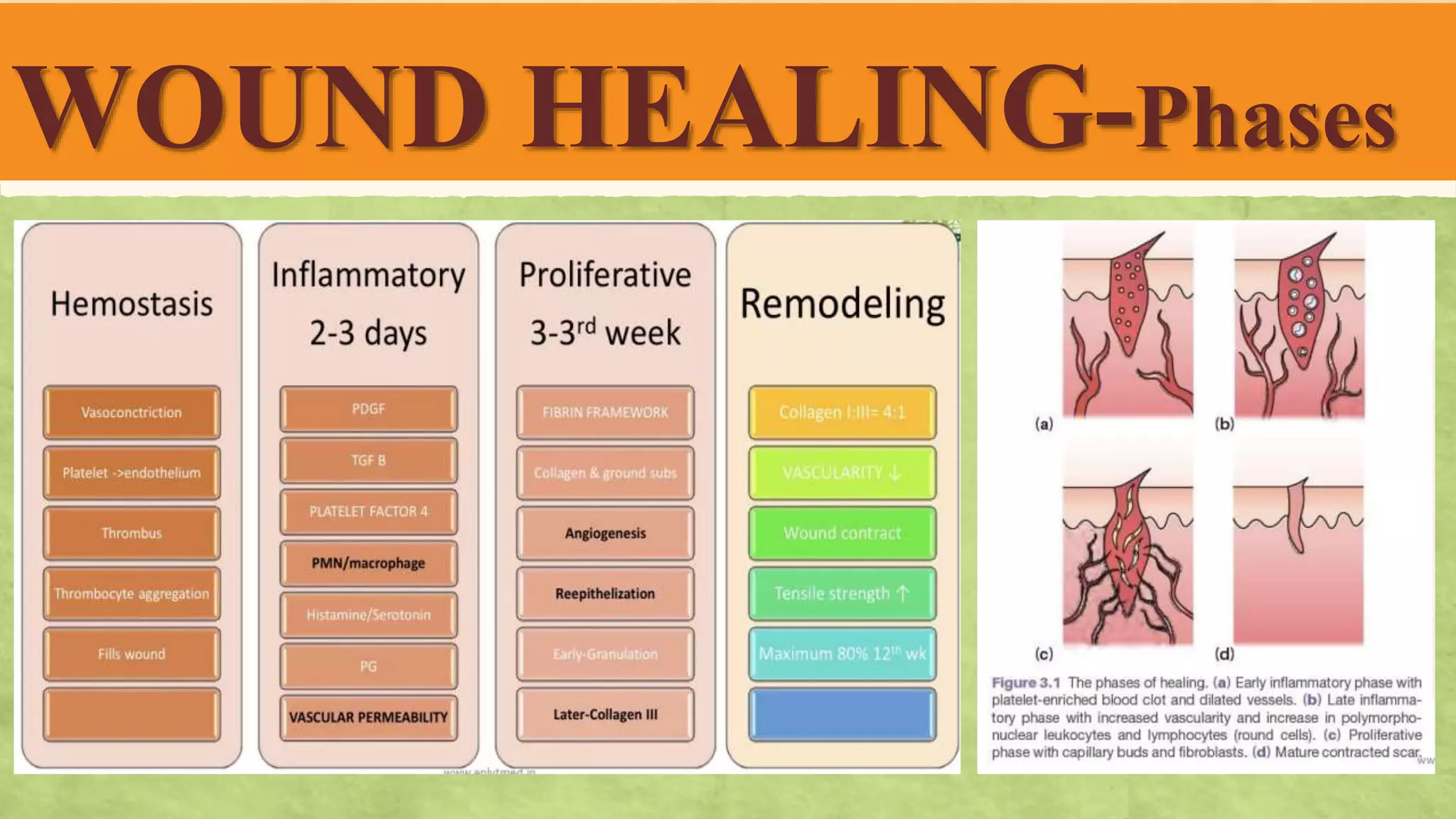 WOUND HEALING- Basic Principles in Surgery.pptx