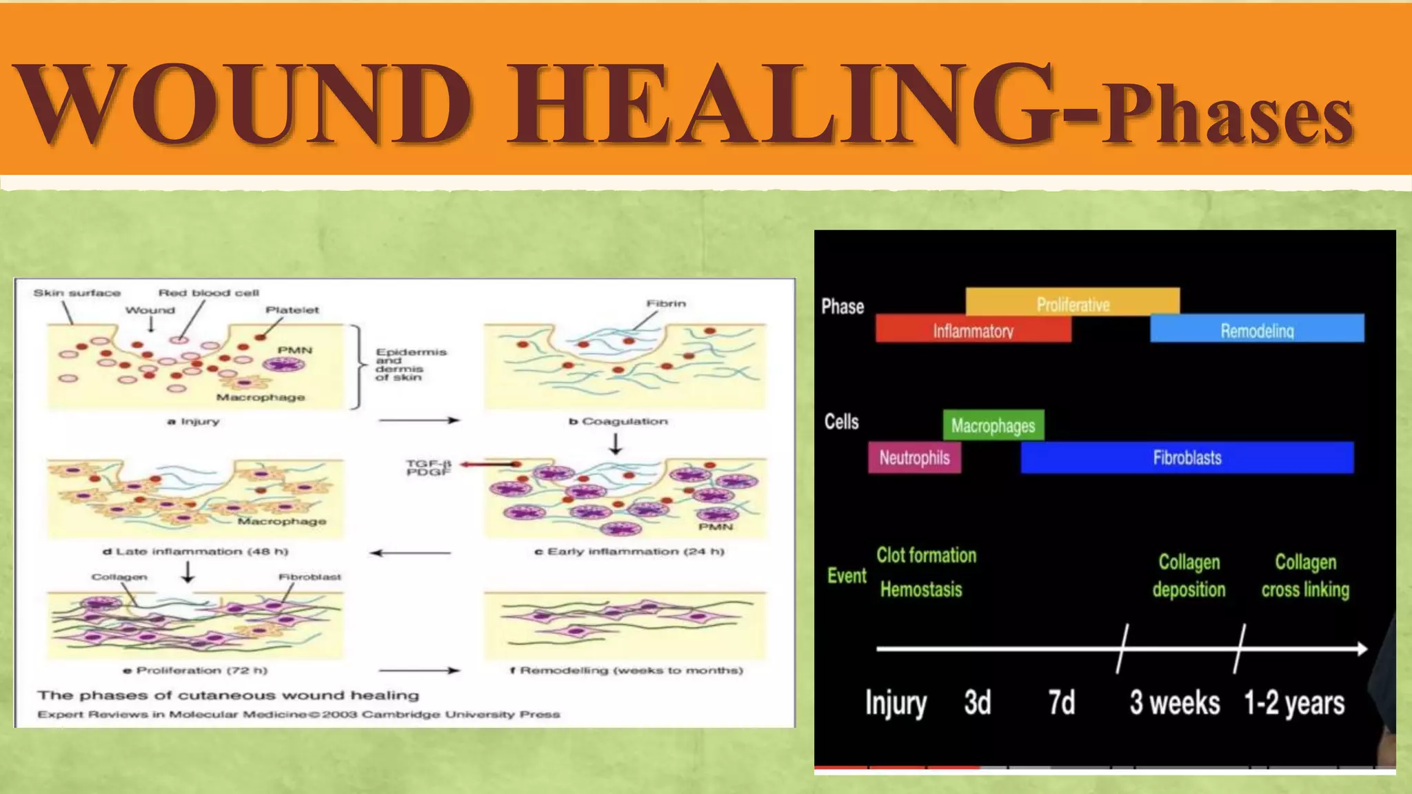 WOUND HEALING- Basic Principles in Surgery.pptx