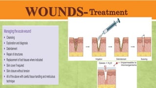 WOUND HEALING- Basic Principles in Surgery.pptx