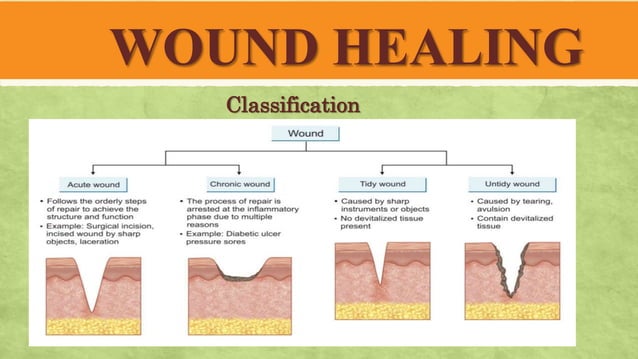 WOUND HEALING- Basic Principles in Surgery.pptx