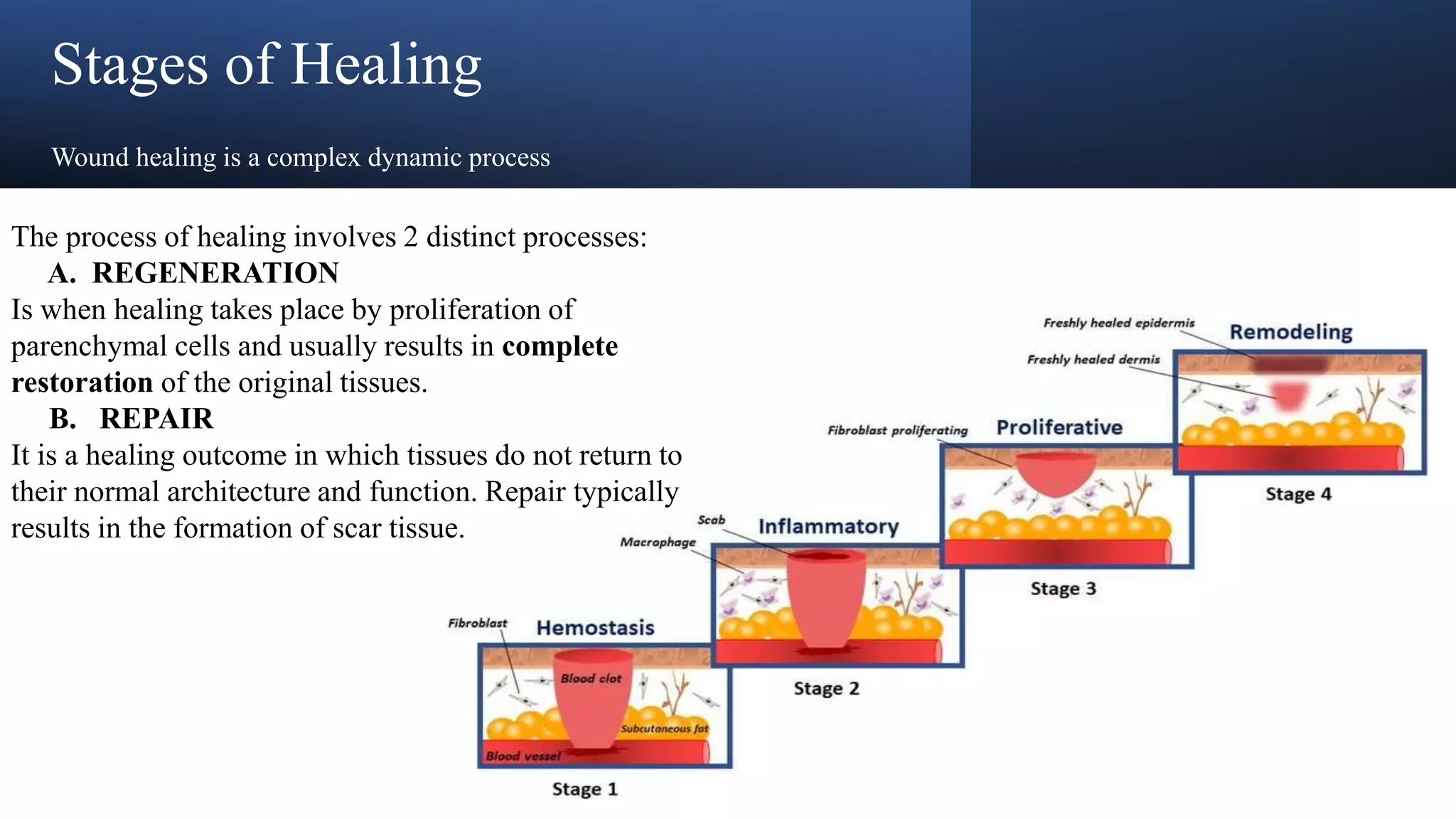 wound healing (1).pptx