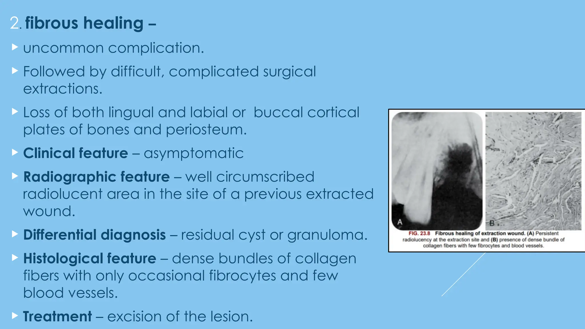 Wound Healing, factors affecting it and its mechanism | PPTX