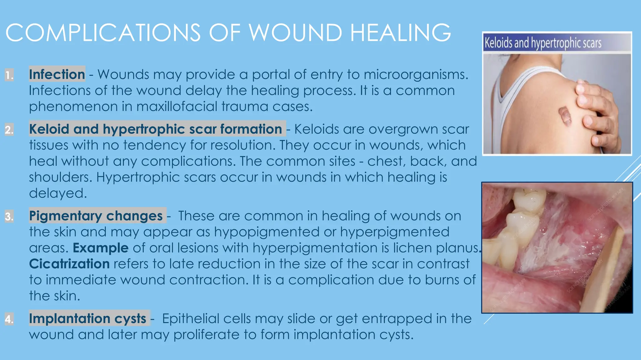 Wound Healing, factors affecting it and its mechanism | PPTX