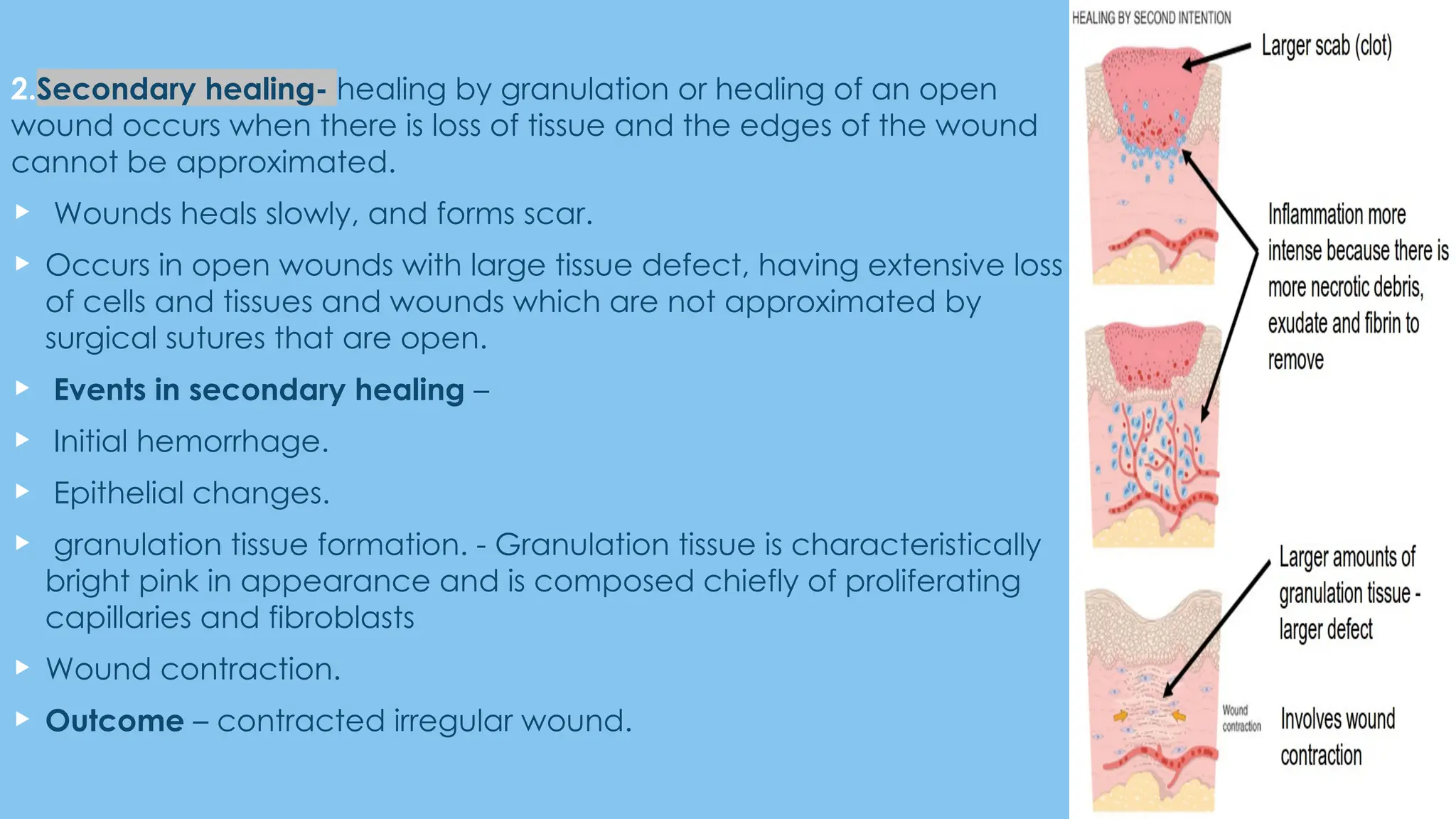 Wound Healing, factors affecting it and its mechanism | PPTX