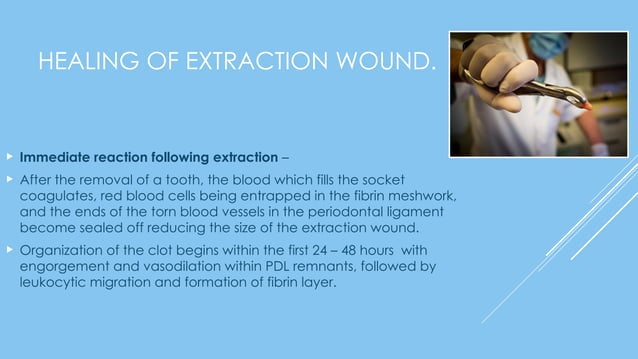 Wound Healing, factors affecting it and its mechanism | PPTX