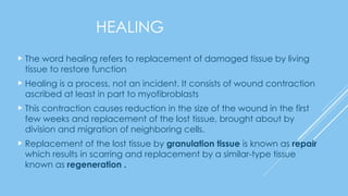 Wound Healing, factors affecting it and its mechanism | PPTX
