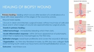 Wound Healing, factors affecting it and its mechanism | PPTX
