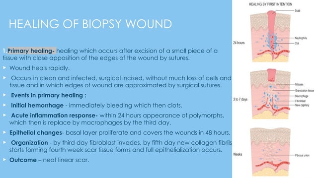 Wound Healing, factors affecting it and its mechanism | PPTX