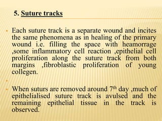 Wound healing | PPTX