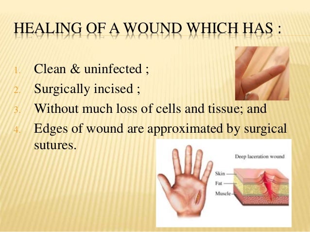Wound healing