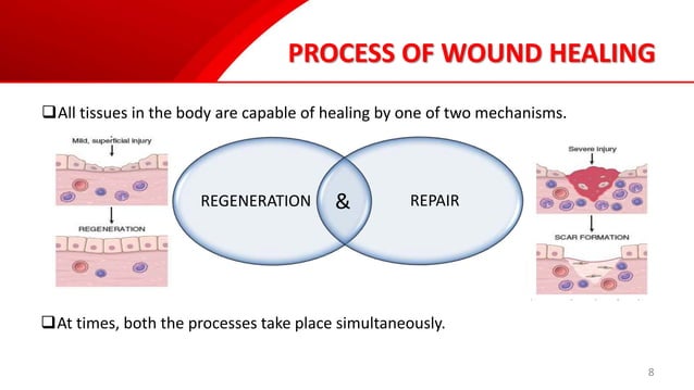 WOUND HEALING2.pptx