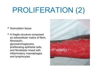 Wound healing ( adesiyakan) | PPT