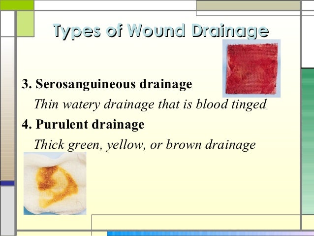 Wound healing and care presentation