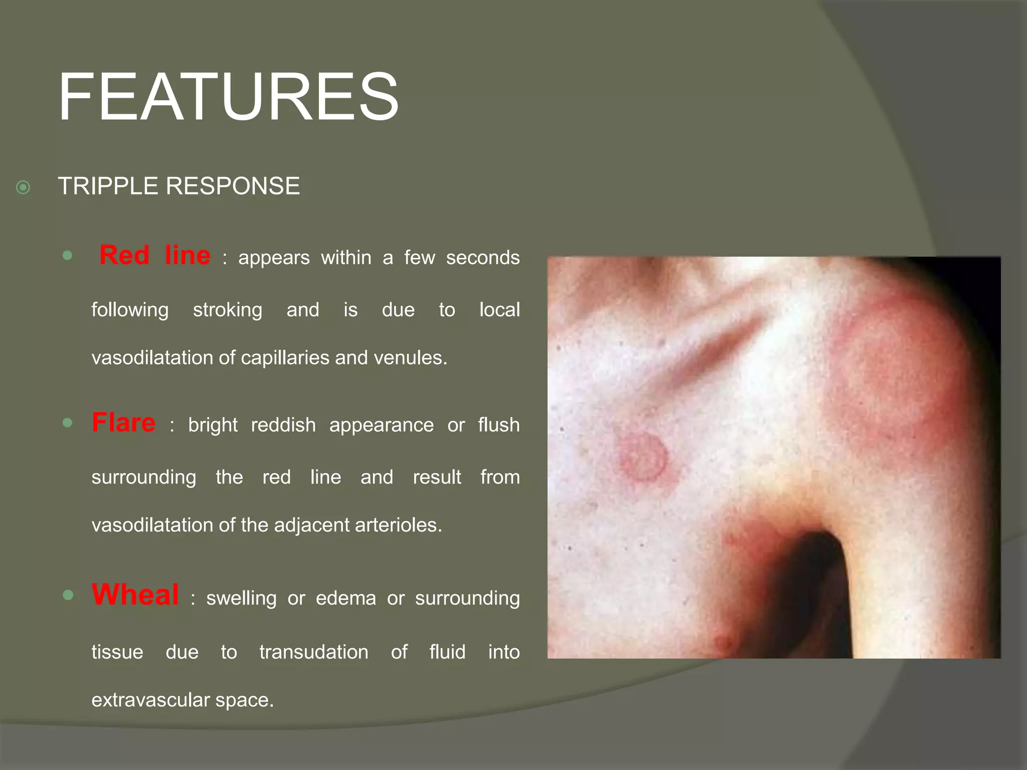 Wound healing and inflammation | PPTX