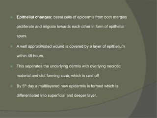 Wound healing and inflammation | PPTX