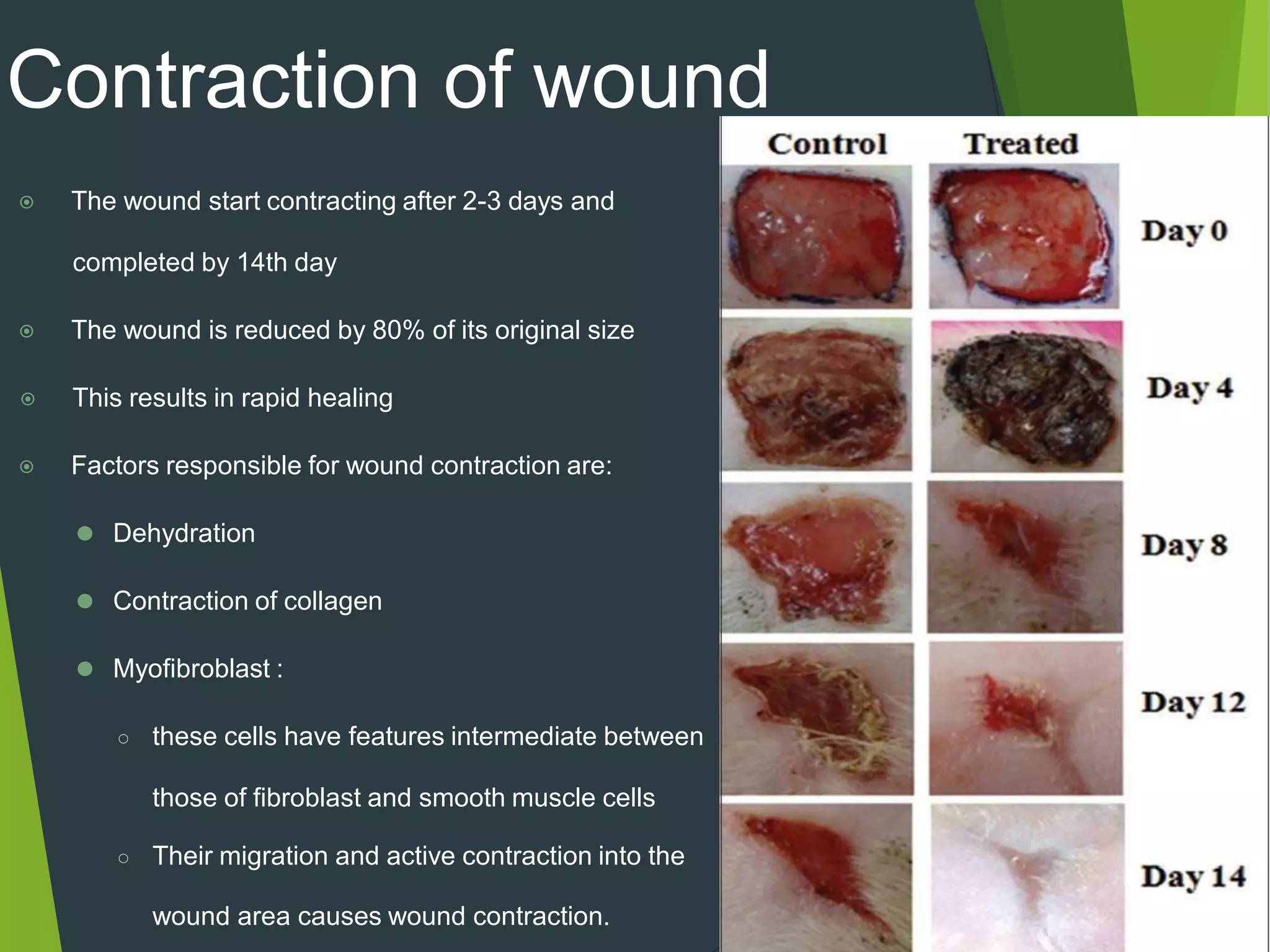 woundhealingandinflammation-181226163636 (1).pptx